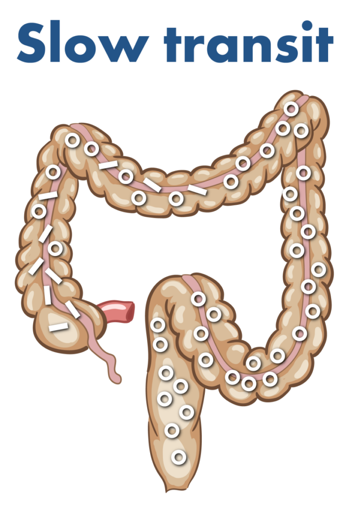 Radiopaque Markers – Medifactia